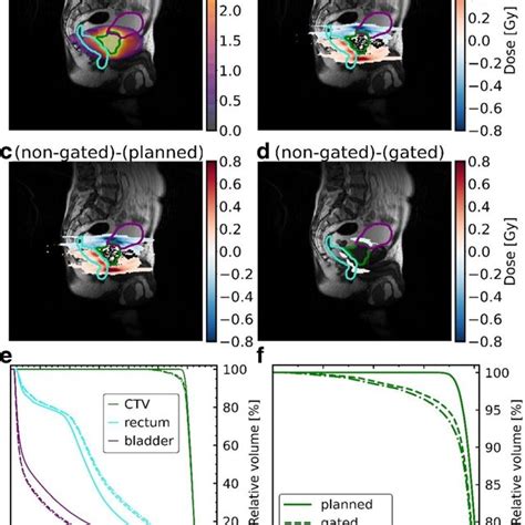 Dose Comparison Of An Exemplary Fraction With Strong Motion Of Download Scientific Diagram