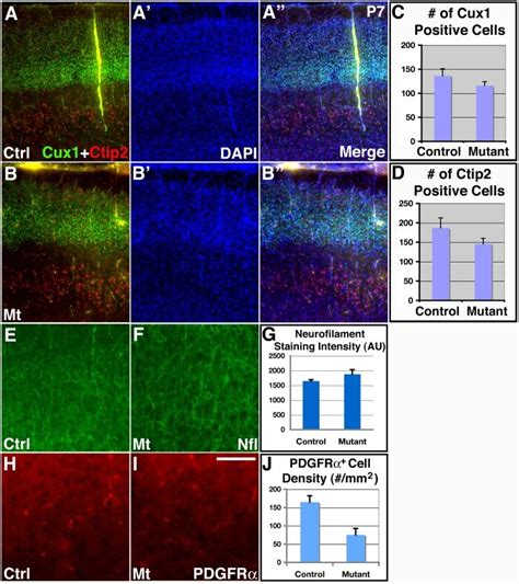 A B” Normal Expression Of Layer Specific Neuronal Markers As Well As Download Scientific
