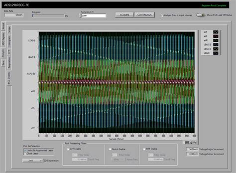 Ads1298ecgfe Pdk Ads1298ecgfe Pdk Data Converters Forum Data Converters Ti E2e Support Forums