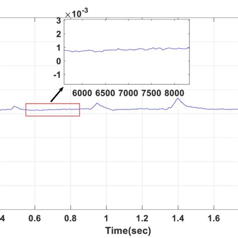 The Comparison Of Original And Denoised Signal Download Scientific Diagram
