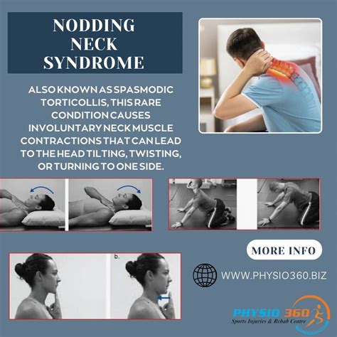 Nodding Syndrome Ns Is A Rare Neurological Disorder Primarily