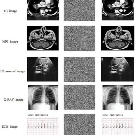 Flow Chart Diagram For The Encryption And Decryption Process Download Scientific Diagram