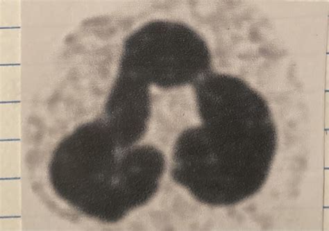 Clinical Lab Procedures Notes Flashcards Quizlet