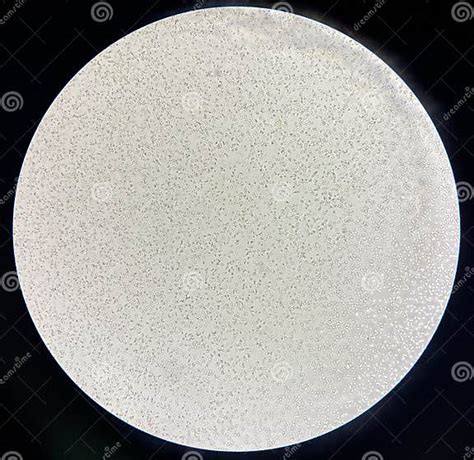 Red Blood Cell Non Agglutination Crossmatching Compatible Donor Stock