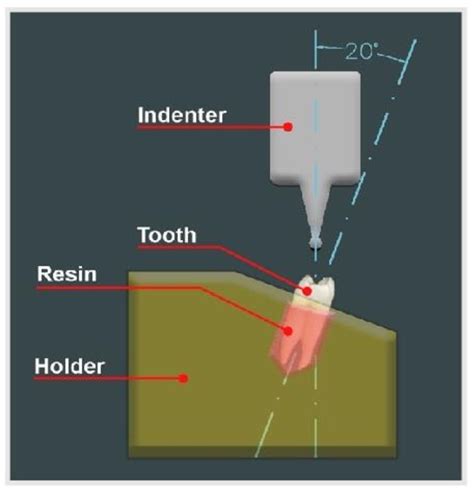 Figure 3 From Impact Of Access Cavity Design On Fracture Resistance Of Endodontically Treated