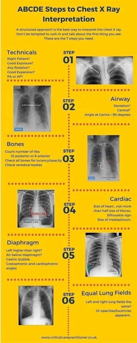 The Heart 🔴abcde Steps To Chest X Ray Interpretation⤵️🔹 Cardiology