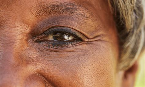 Diabetic Maculopathy And Diabetic Macular Oedema