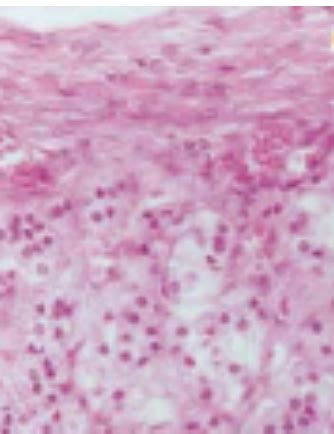 Exam Flashcards Quizlet