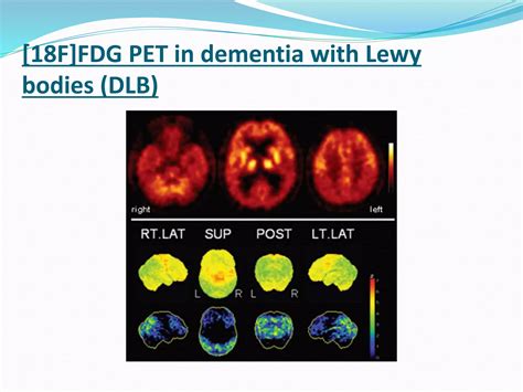 Functional Neuroimaging Pptx Pptx
