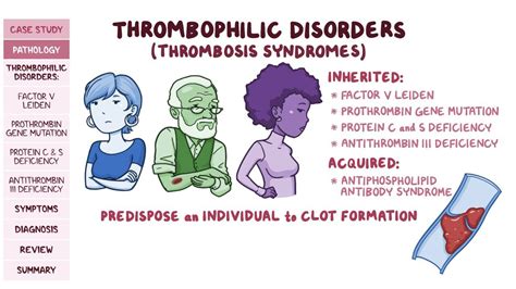 Thrombosis Syndromes Hypercoagulability Pathology Review Osmosis