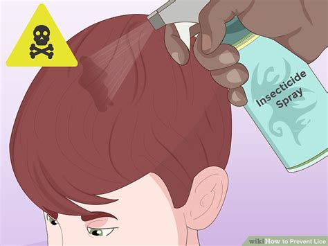 How To Prevent Lice Steps With Pictures WikiHow