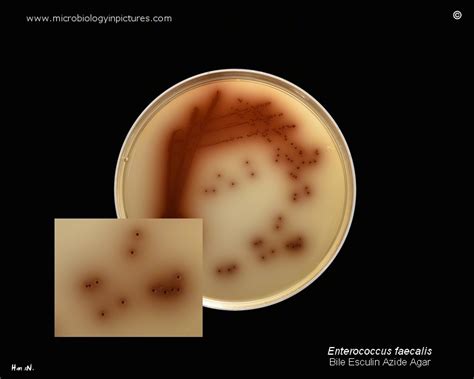 Bile Esculin Azide Agar Enterococcus Faecalis Growth On Bile Esculin