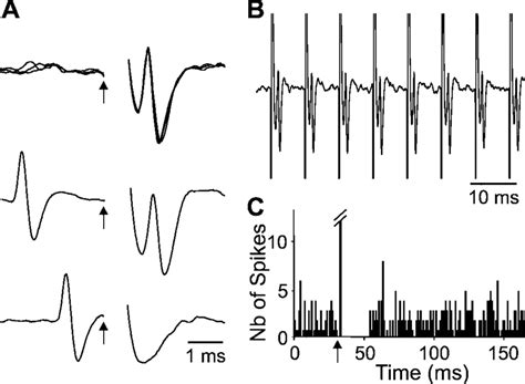 Antidromic Activation Of A Snr Cell During Stn High Frequency
