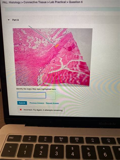 Solved PAL Histology Connective Tissue Lab Practical Answer Transtutors