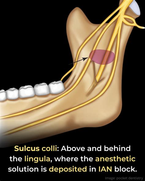 Dental Inferior Alveolar Nerve Block Ianb Injection Site And Technique 🔵 Structures