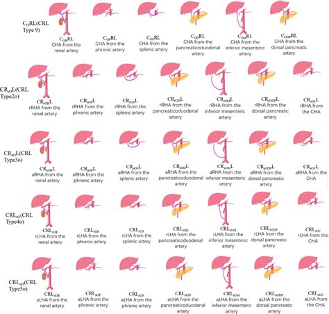 Types And Diagrams In Ex CRL Classification System Download Scientific Diagram