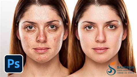 Kỹ Thuật Frequency Separation Là Gì Cách Sử Dụng Trong Photoshop