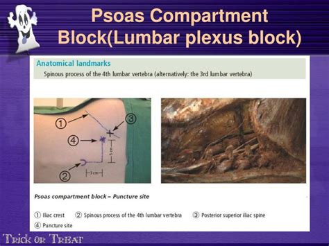 Ppt Lower Extremity Peripheral Nerve Block R4 장 지 혜 Powerpoint Presentation Id 911033