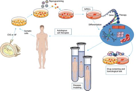 Representation Of The Workflow For The Derivation Of Patient Specific Download Scientific