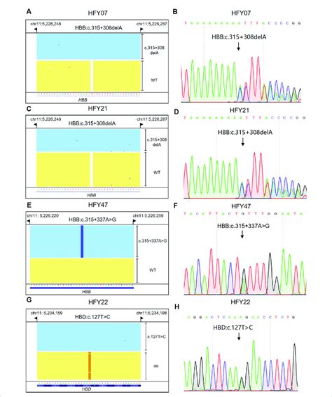 Integrative Genomics Viewer Plots And Sanger Sequencing Of The Snvs And