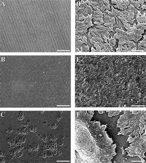 Scanning Electron Micrographs Of The Different Disk Surfaces Used In