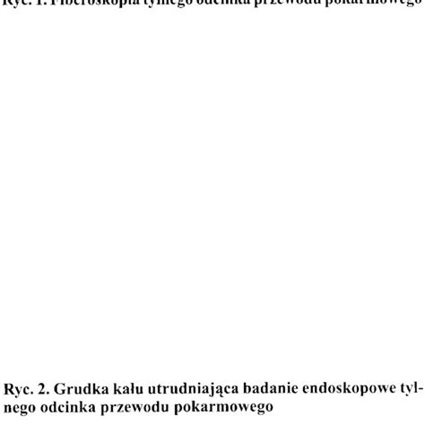 Diagnostic Algorithm For The Investigation Of Gi Bleeding Download