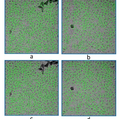 Particle Picking Before And After Iterative Training And Picking
