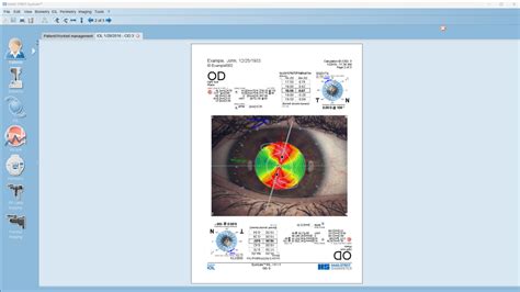 Eyestar 900 Eyesuite Iol