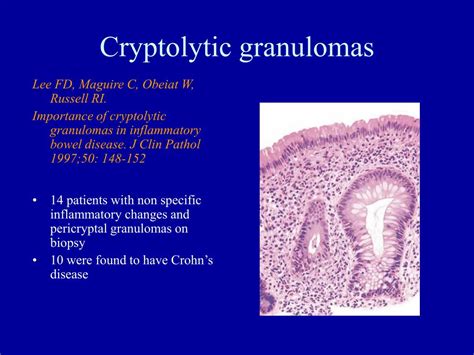 Ppt Pathology In The Selection Of Patients For Pouch Surgery