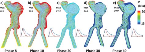 Fluid Domain Results From The Fully Coupled Fsi Simulation With Three Download Scientific