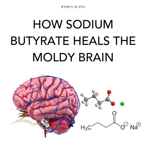 I Believe Sodium Butyrate Is A Mold Illness And Cirs Extraordinaire