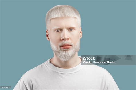 청록색 스튜디오 배경에서 포즈를 취하는 티셔츠를 입은 알비노 남자의 초상화 특이한 외관 피부 이상 개념 알비노에 대한 스톡 사진