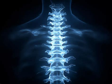How To Pursue A Lawsuit For Spinal Cord Injuries After A Car Accident