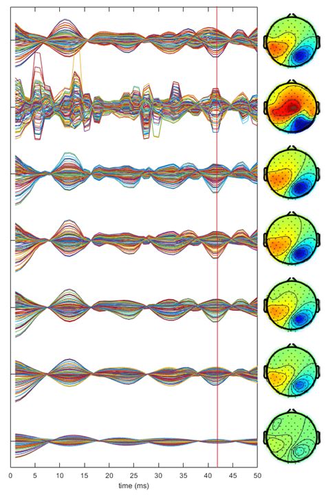 Eeg Time Series Plot Of The Uncorrupted Eeg Signal Corrupted Eeg