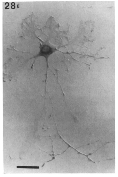 Higher Magnification Of A Stellate Subtype Grown For 28 Days The Label Download Scientific