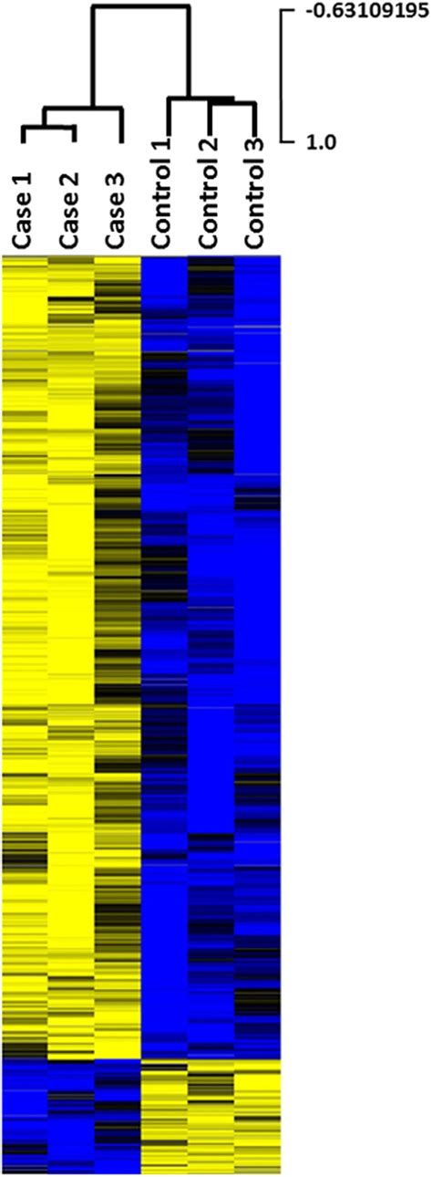 Heat Map Of 1642 Alternative Splicing Events Hierarchical Cluster Download Scientific Diagram