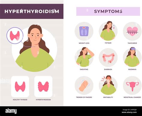Hyperthyroidism Symptoms Infographic Overactive Thyroid Gland Disease Endocrine System Health
