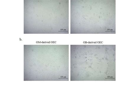 Morphological Difference Of Purified Oecs On Day 7 And 28 Post Download Scientific Diagram