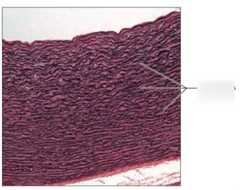 Elastic Tissue Labeled Elastic Fiber Wikipedia