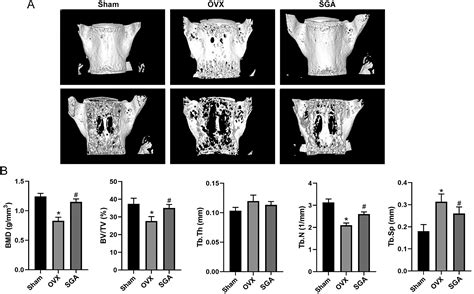 Shen Gu An Capsule Inhibition Of Postmenopausal Osteoporosis In