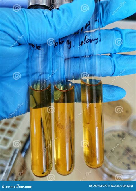 Tryptone Soya Broth Stock Image Image Of Glass Food 299766973