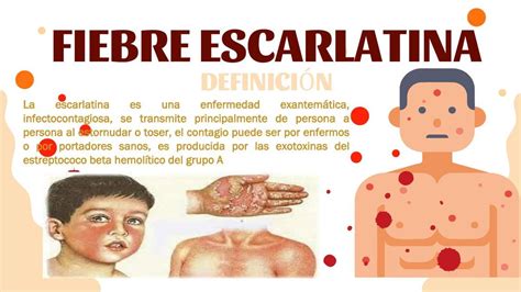 Escarlatina Doctorteco Udocz