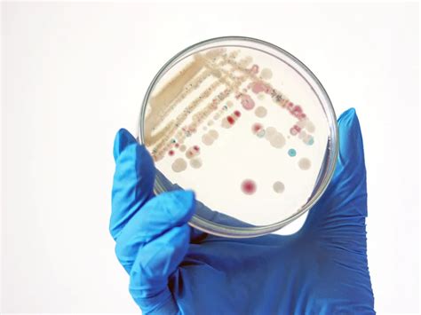 Vibriosis What Canadians Should Know About Raw Seafood As Us Mom