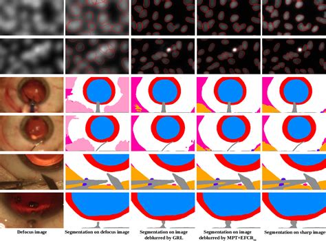 Figure 1 From A Unified Framework For Microscopy Defocus Deblur With Multi Pyramid Transformer