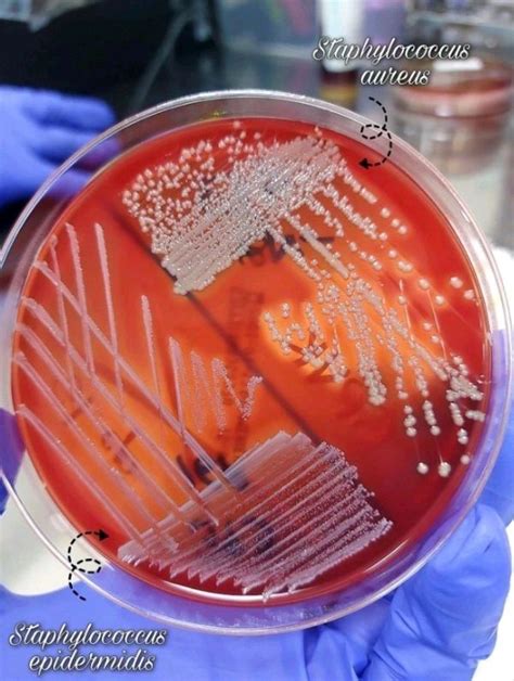 Staphylococcus Aureus And Epidermidis Similarities Probity Bioresearch Company Ltd Posted On