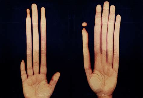 20 Techniques Scanogram Ideas Photography Art Photography Photography Inspiration