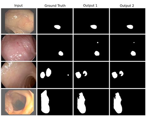 Doubleunet For Medical Image Segmentation Debesh Jha