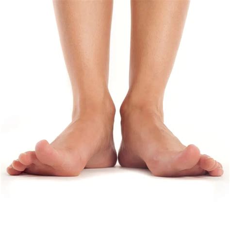 Splay Foot Exercises Relieve Foot Pain Liebscher And Bracht