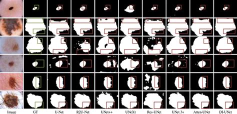 Visual Comparison On Some Representative And Challenging Images On The Download Scientific