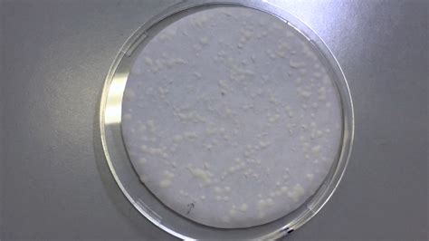 Video Author Spotlight Enhanced Isolation Of Interaction Null Mutants In Yeast